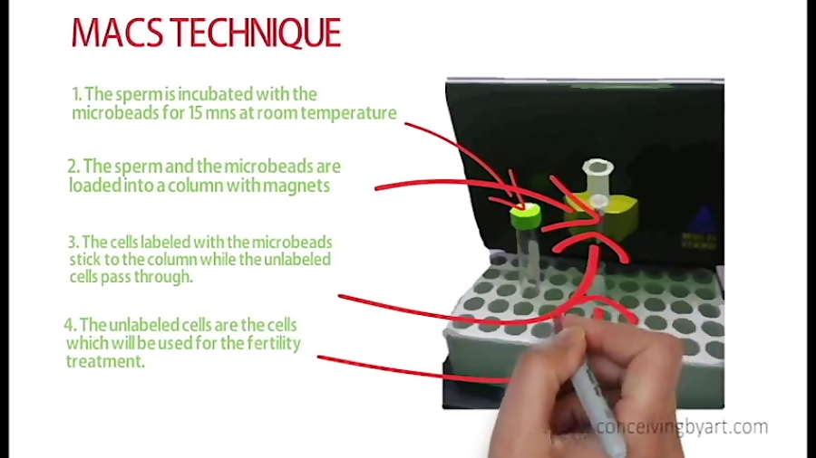 MACS (Magnetic Activated Cell Sorting).