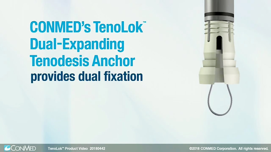 Tenolok™ Dual Expanding Tenodesis Anchor - CONMED Product Video