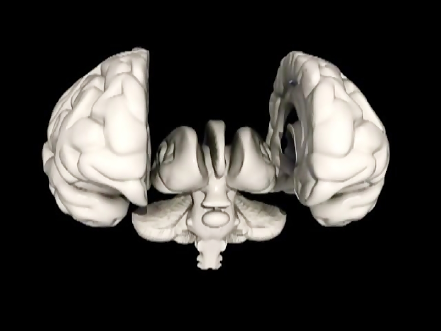 An Introduction to PRISM Brain Mapping