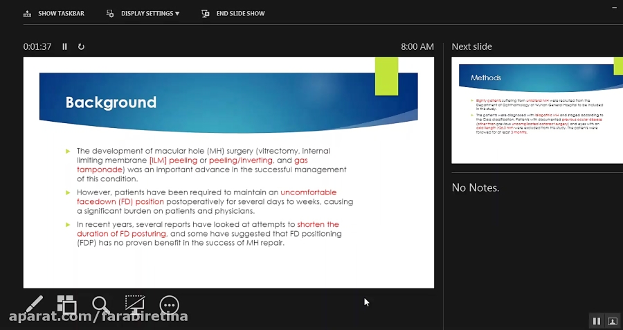 Face Down Positioning after Vitrectomy for Macular Hole