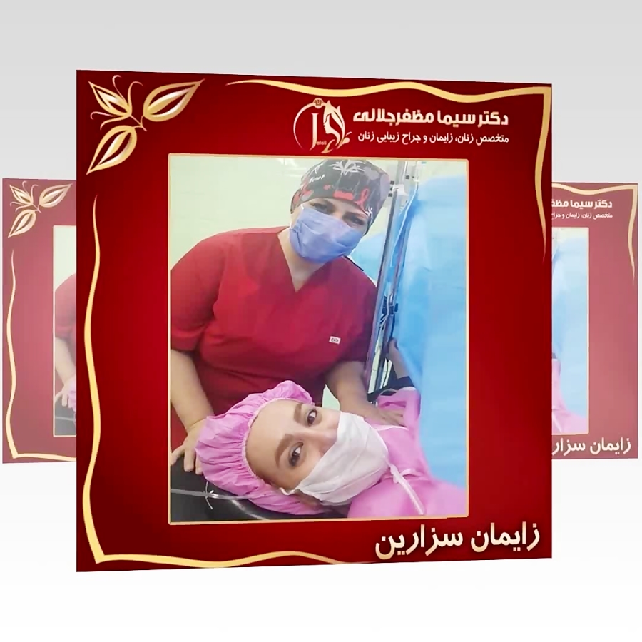 زایمان سزارین دکتر سیما مظفر جلالی