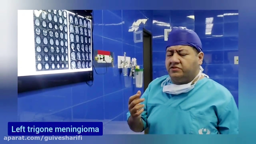Left Trigone Meningioma