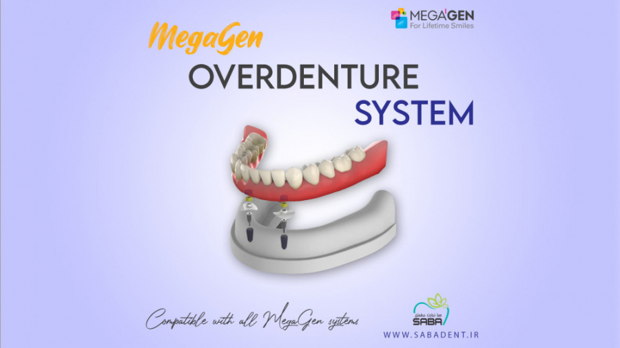 Megagen Overdenture System | سیستم اوردنچر مگاژن | صبا تجارت