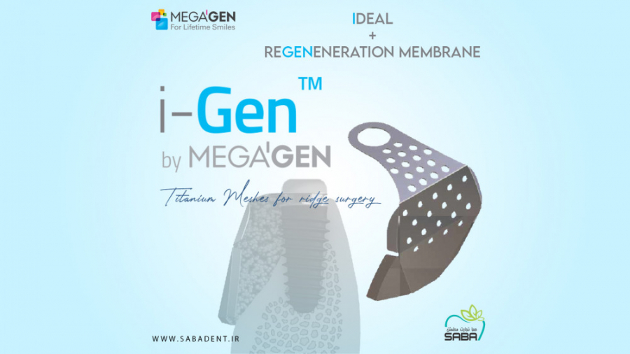 i-gen megagen | مش تیتانیوم آی جن مگاژن | صبا تجارت