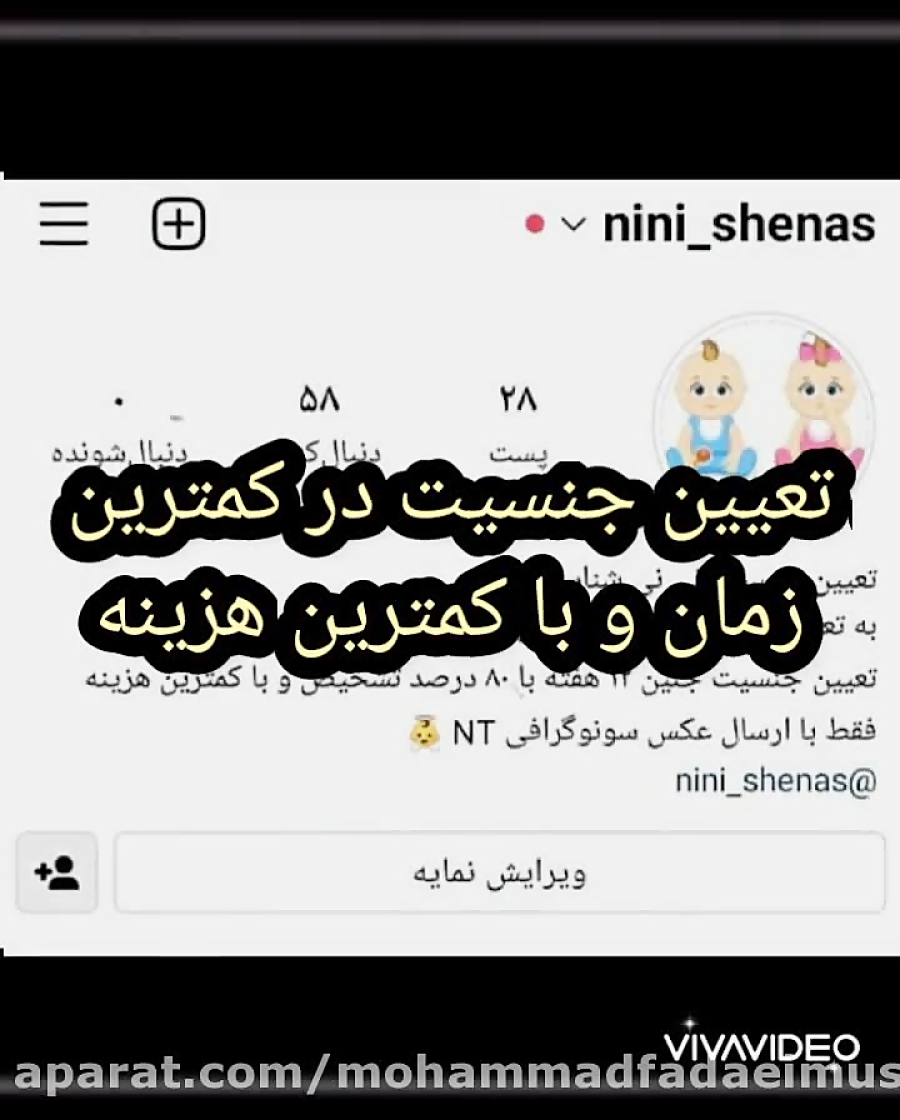 تعیین جنسیت جنین به صورت حرفه ای در 12 هفتگی