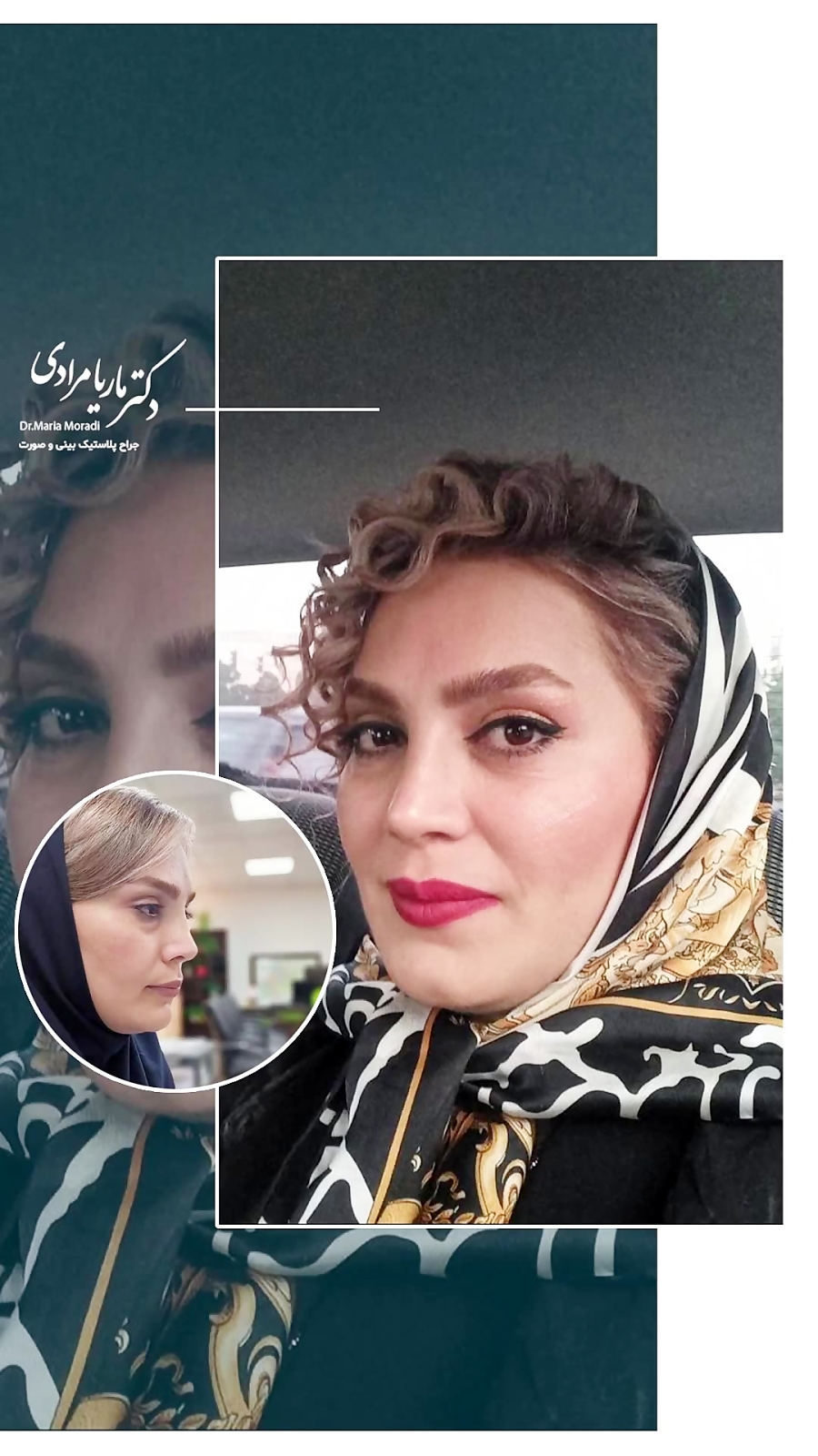 جراحی زیبایی بینی