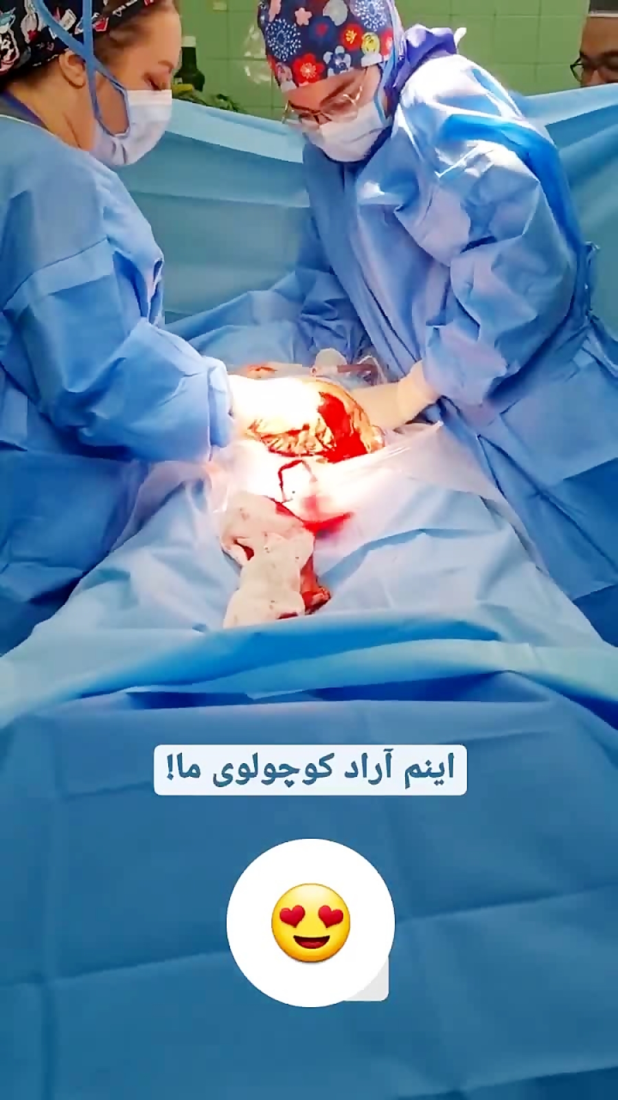فیلم زایمان سزارین