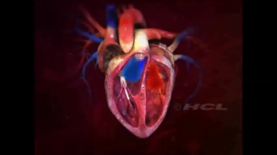 انیمیشن آموزشی: قلب چگونه کار می کند؟