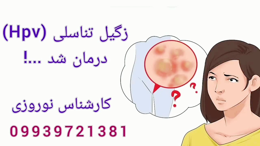 زگیل تناسلی در زنان