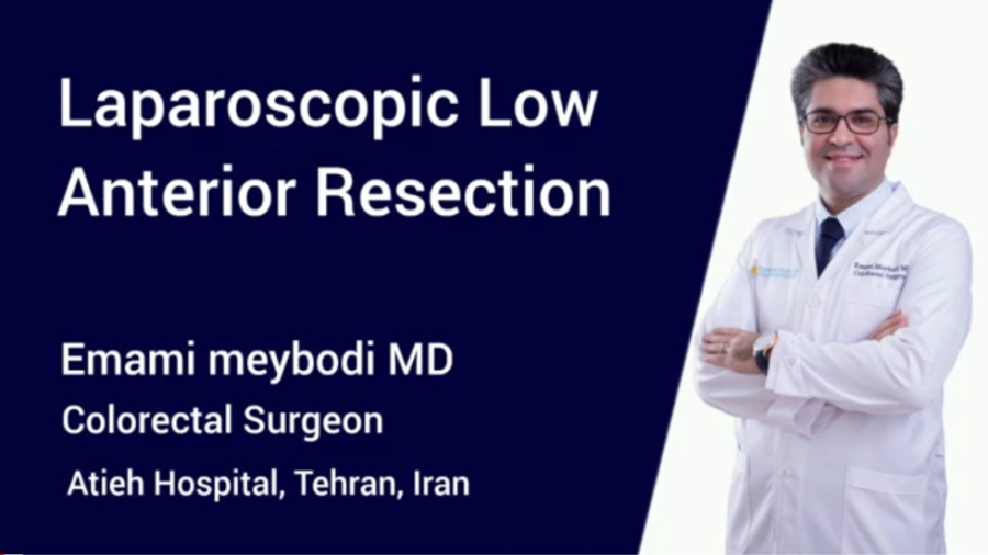 Laparoscopic Low Anterior Resection, Step by Step